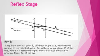 Optics of Retinoscope by Dr. Muhammad Zeeshan Hameed.pptx | Eye and ...