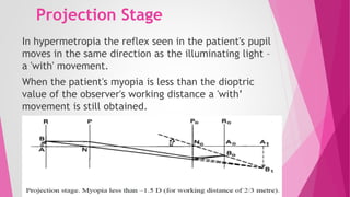 Optics of Retinoscope by Dr. Muhammad Zeeshan Hameed.pptx