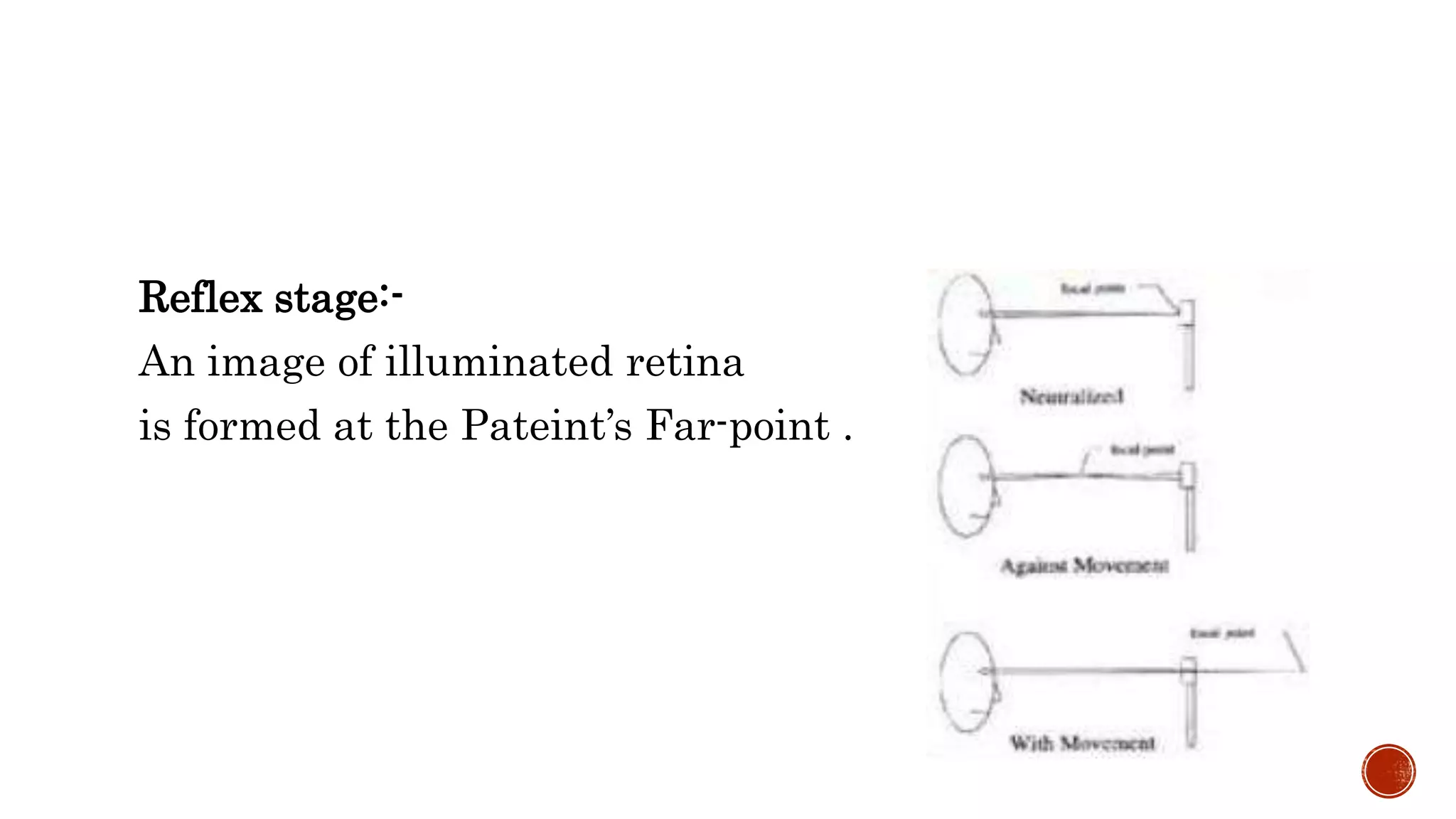 retinoscope & retinoscopy.pptx