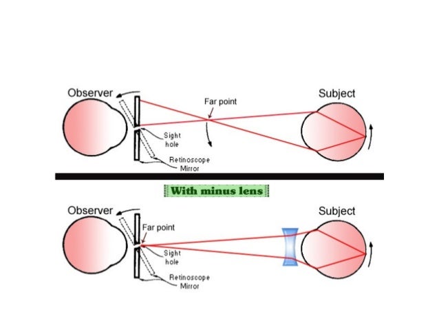 Retinoscopy