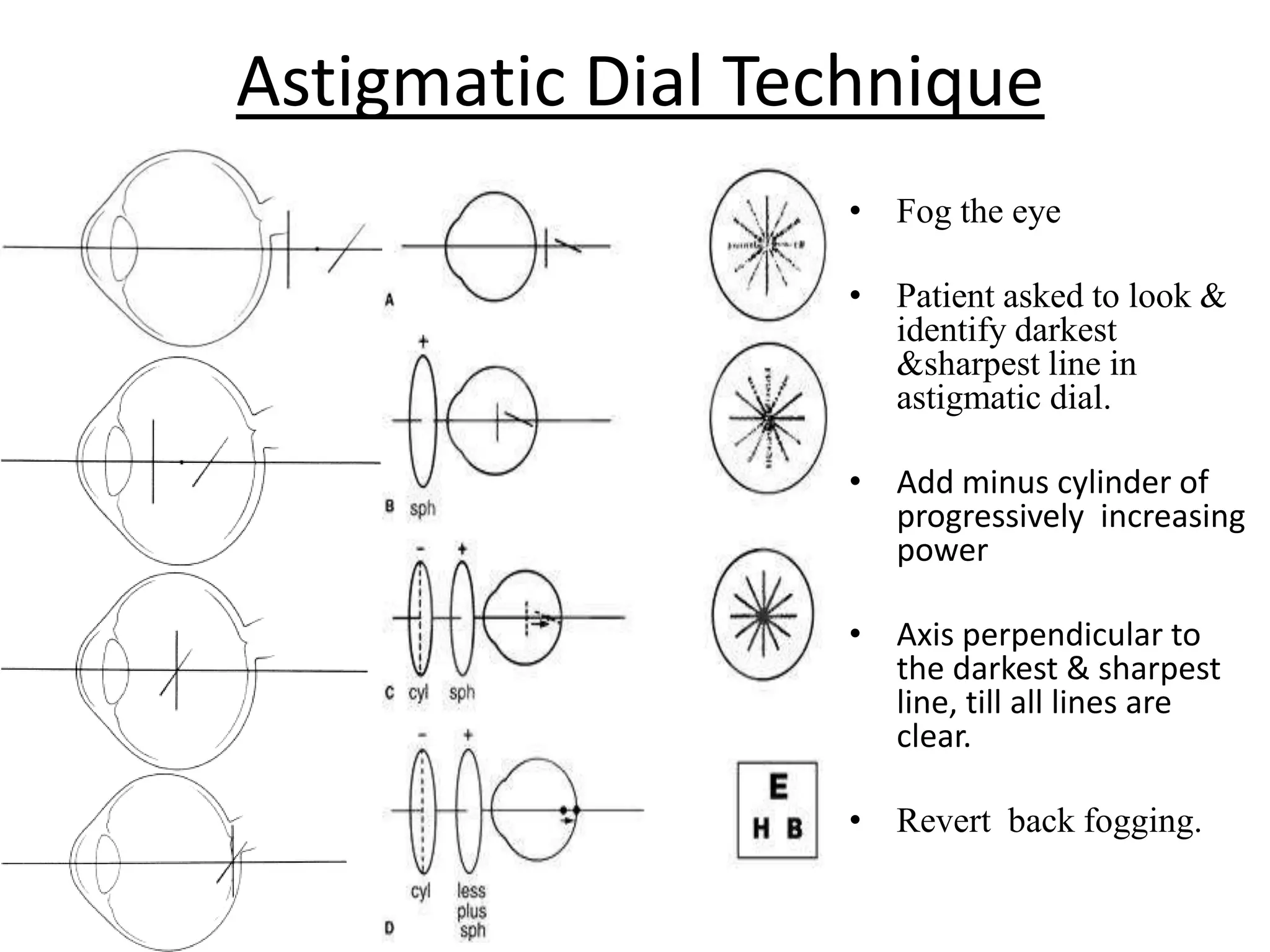 Retinoscopy | PPTX