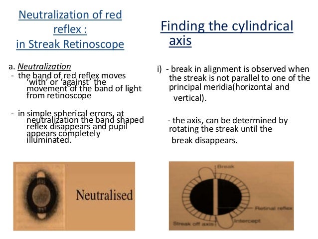 Retinoscopy