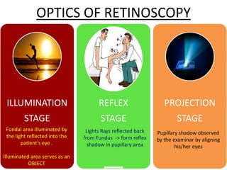 Retinoscopy | PPT