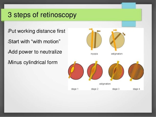 Retinoscopy by Pratyush