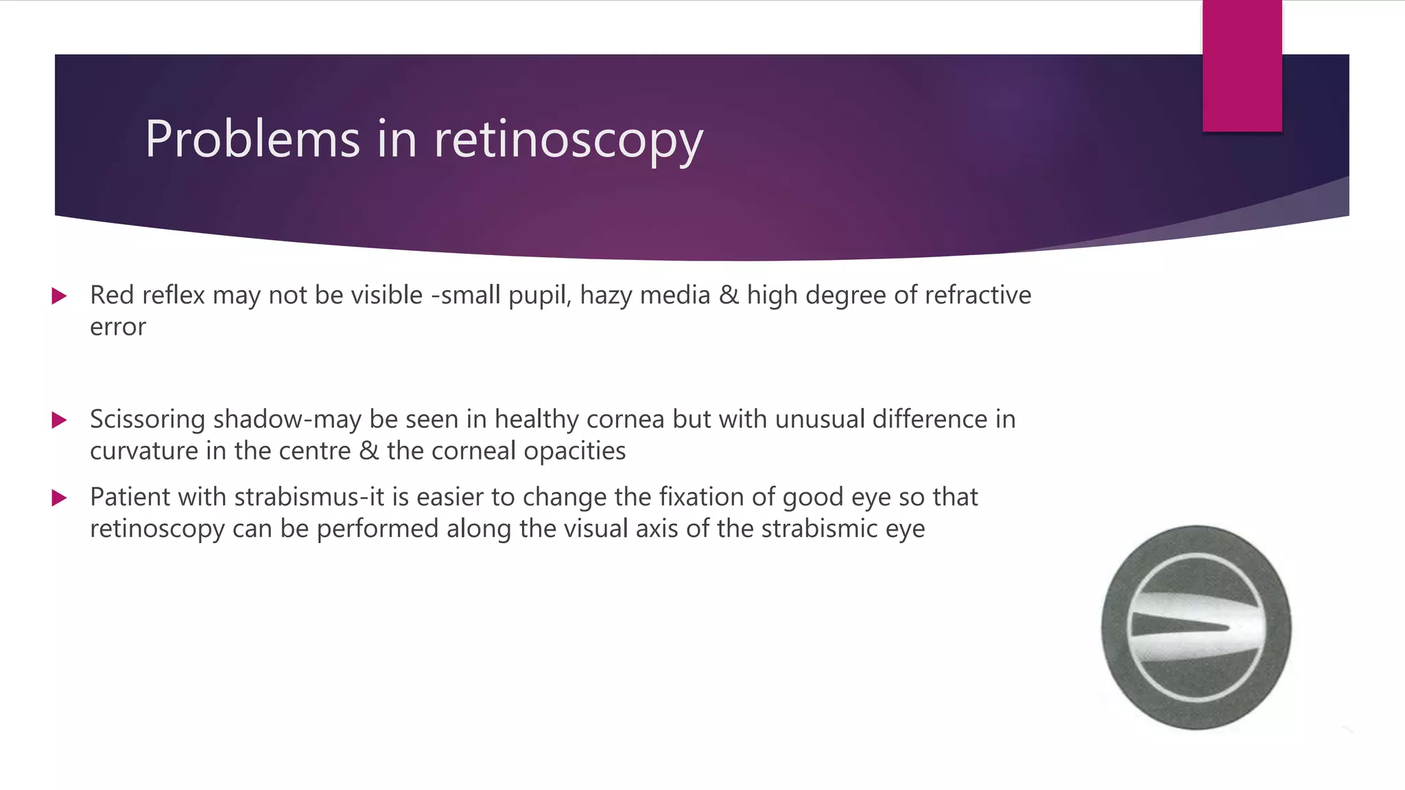 Retinoscopy | PPTX