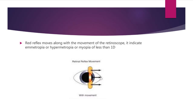 Retinoscopy | PPTX
