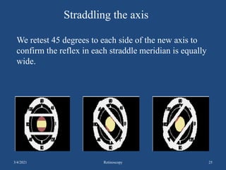 Retinoscopy | PPT