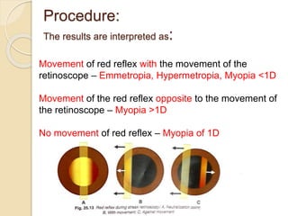 Retinoscopy dr.asif siddiqui | PPTX | Eye and Vision Conditions ...