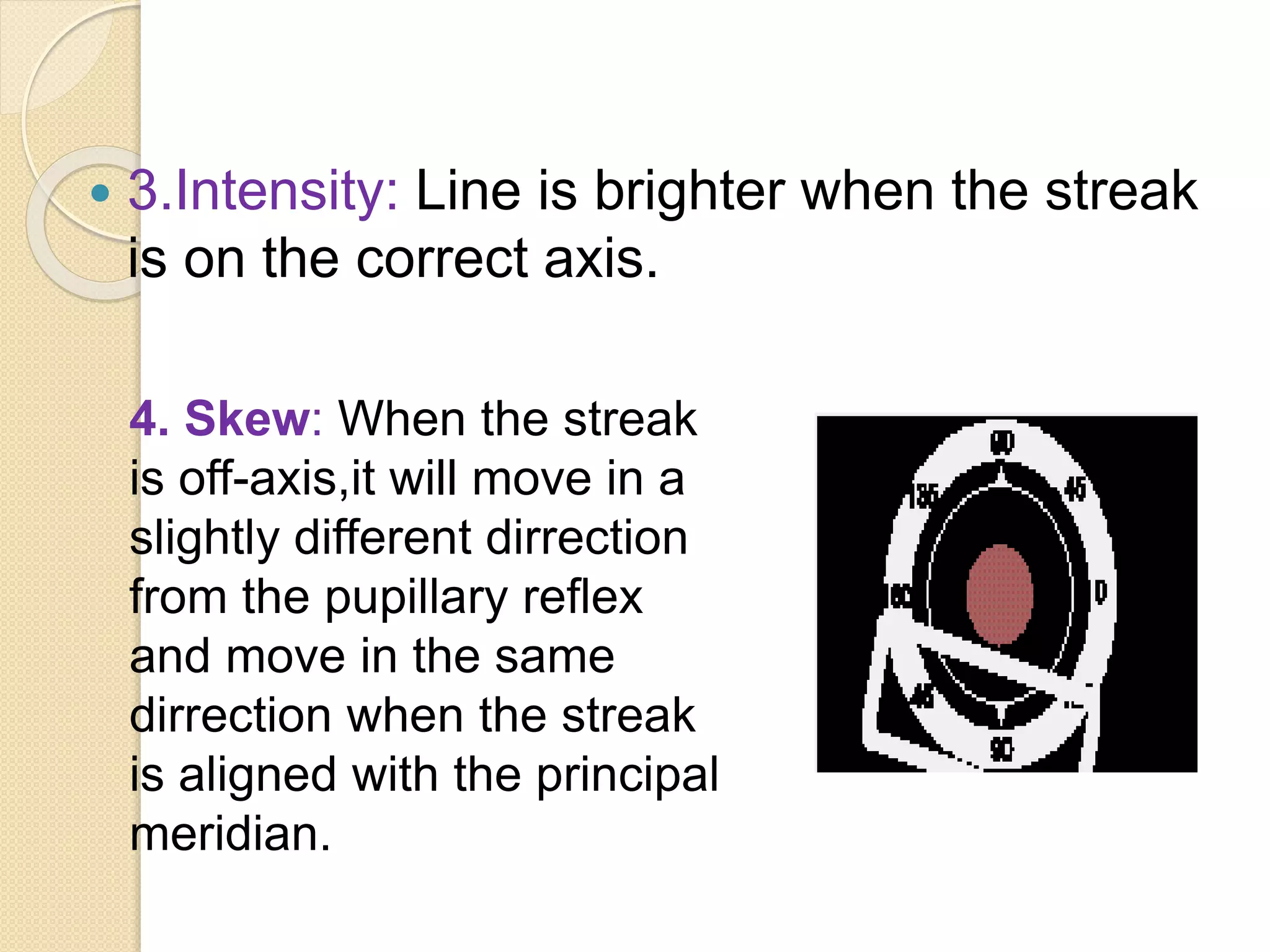 Retinoscopy @adi | PPTX