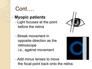 Retinoscopy @adi | PPTX