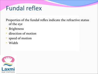 Retinoscopy and its principles | PPT