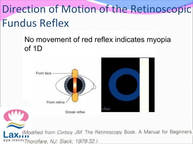 Retinoscopy and its principles | PPT
