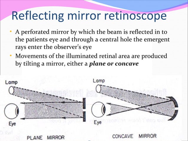 Retinoscopy and its principles | PPT