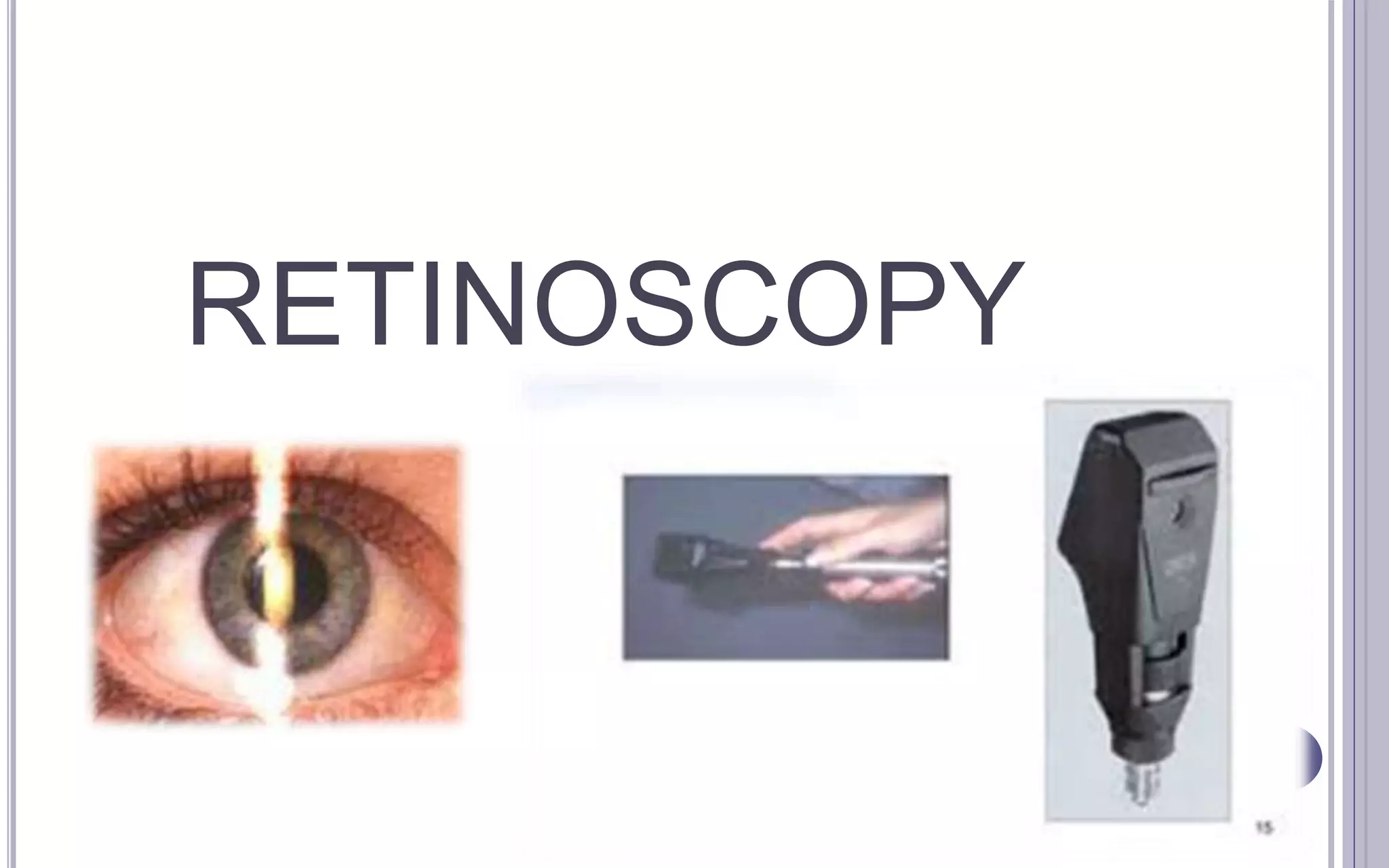 Retinoscopy & Autorefractometry | PPT