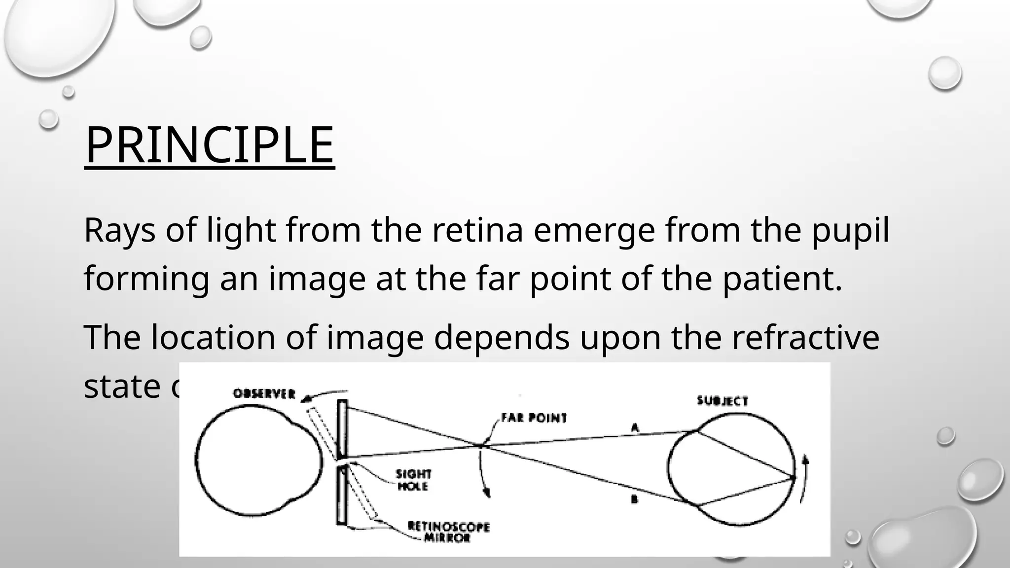 Retinoscopy ophthalmology procedure cycloplegic observation ...