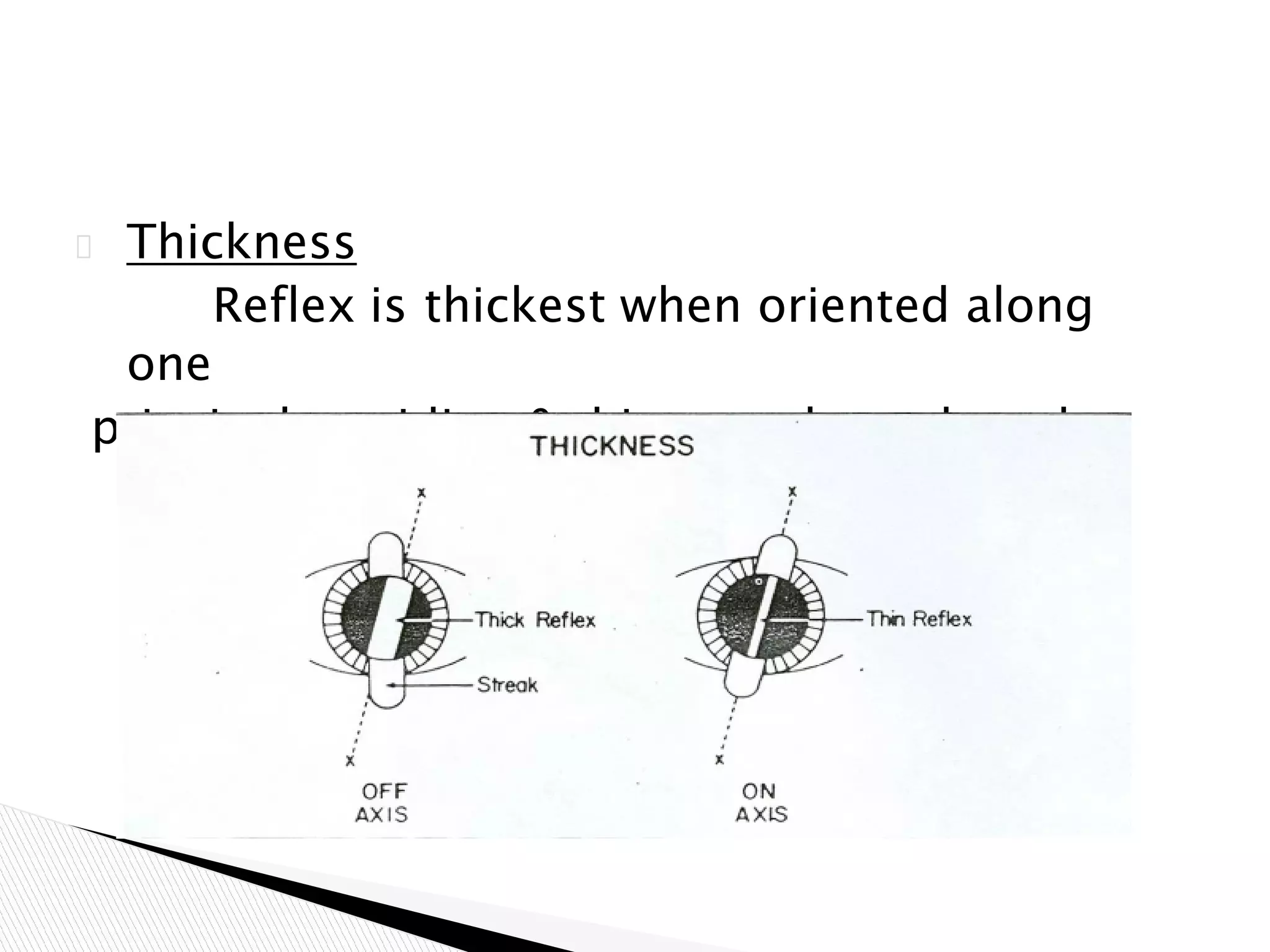 Retinoscopy ppt | PDF