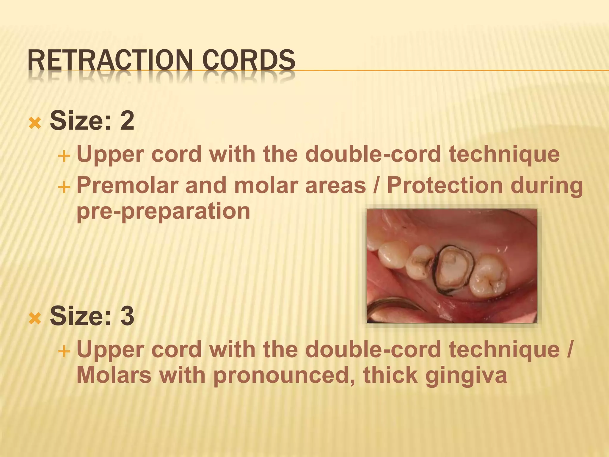 Retraction cords | PPTX