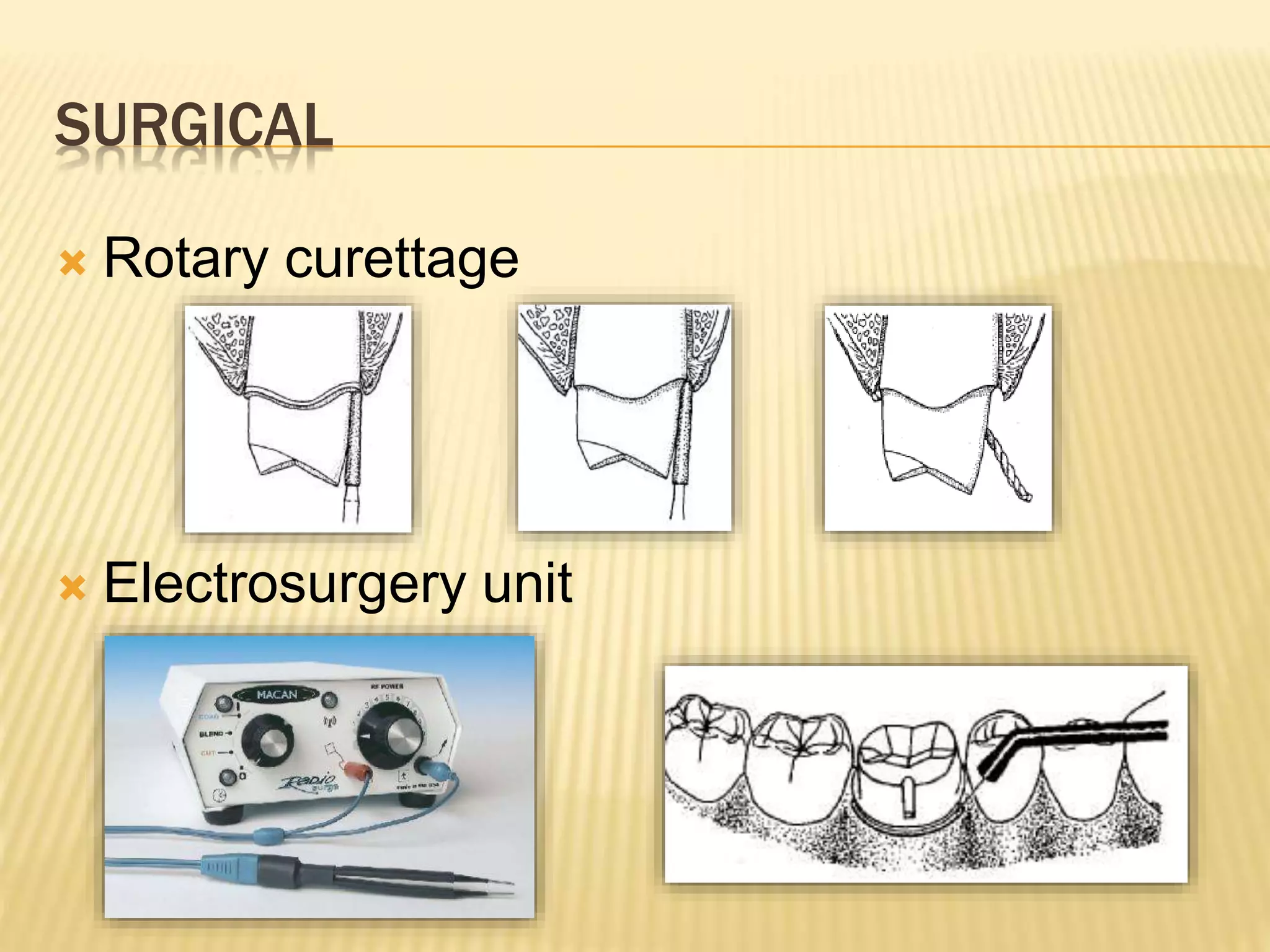 Retraction cords | PPTX