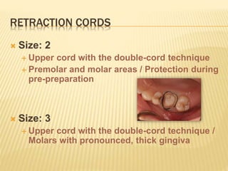 Retraction cords | PPTX