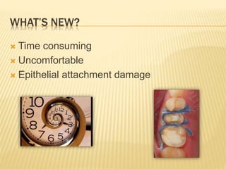 Retraction cords | PPTX