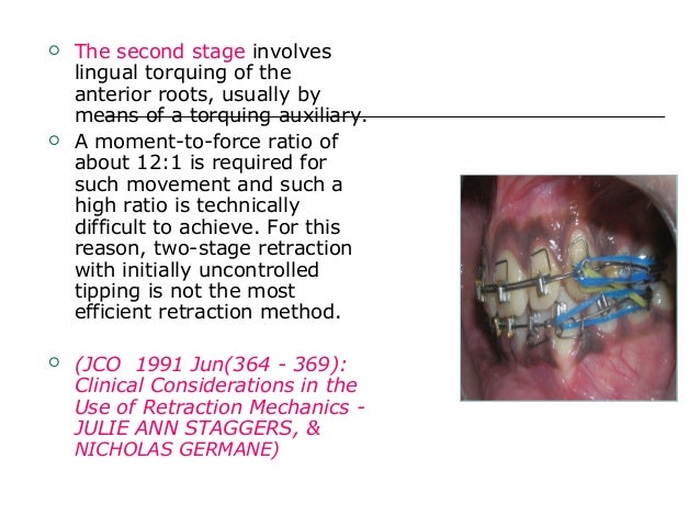 Retraction mechanics