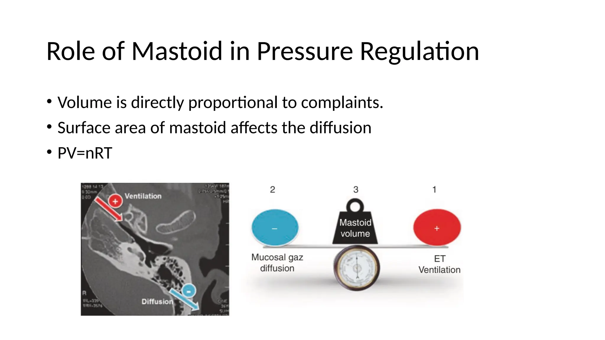 Retraction Pocket in Ear Cholesteatoma.pptx