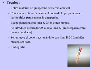El retratamiento de conducto en odontologia | PPT