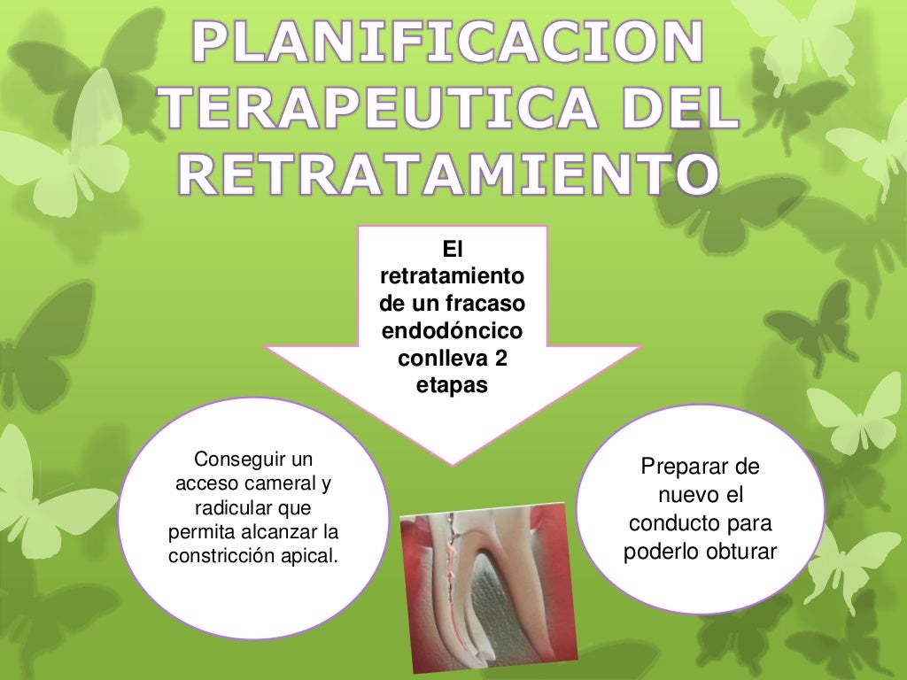 Retratamiento endodontico