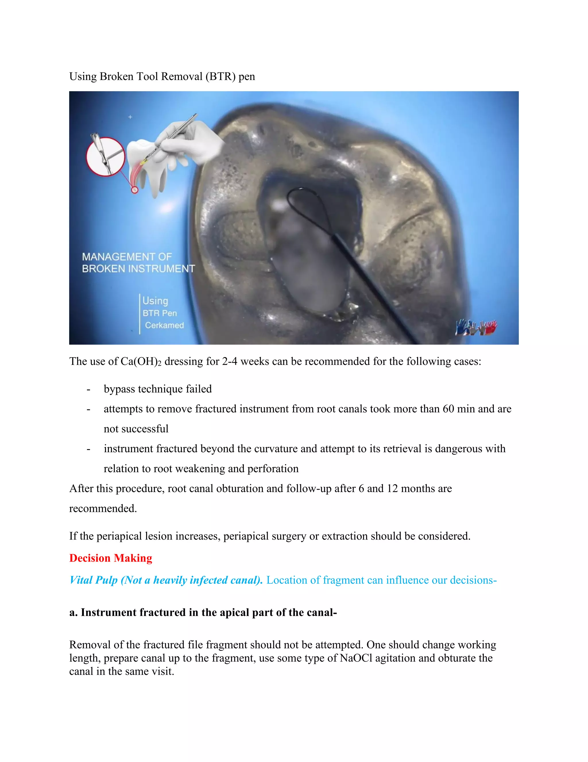 Retrieve, bypass or entomb for an endodontic separated file | PDF