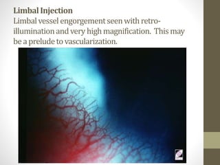 Retro illumination | PPTX