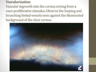 Retro illumination | PPTX