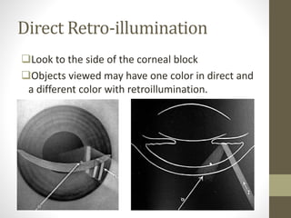 Retro illumination | PPTX