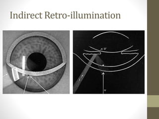 Retro illumination | PPTX