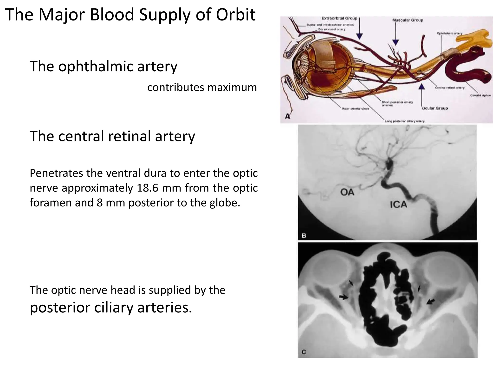 retrobulbar hemorrhage - anatomy physiology.pptx