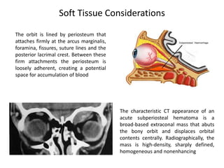 retrobulbar hemorrhage - anatomy physiology.pptx