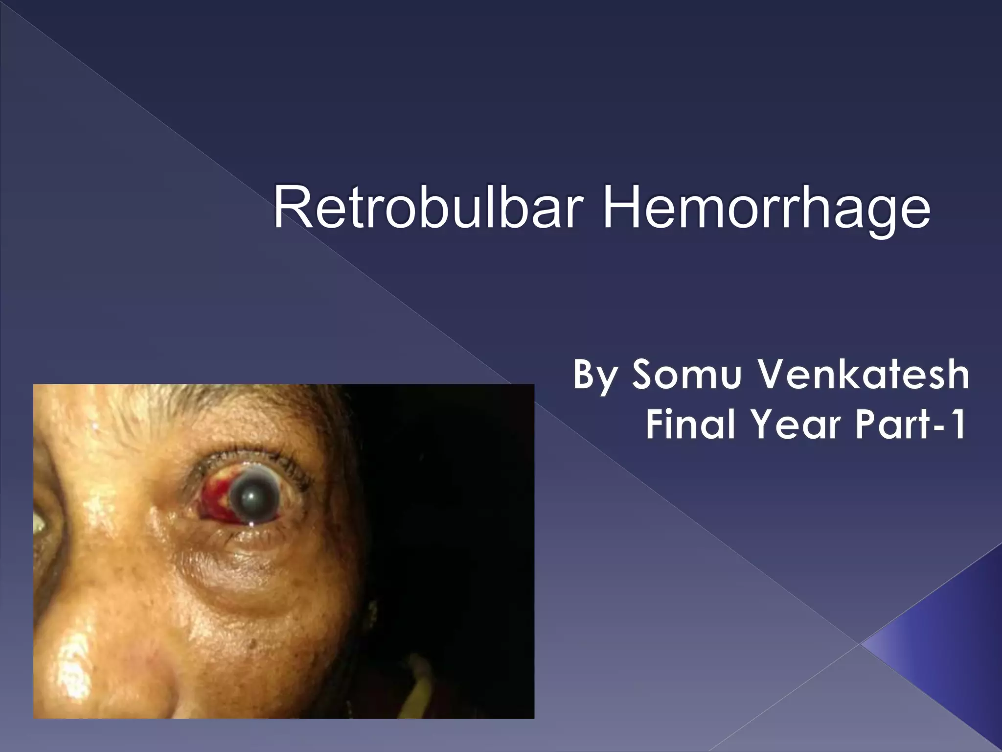 Retrobulbar hemorrhage by Somu Venkatesh | PPTX
