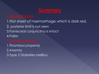 Retrobulbar hemorrhage by Somu Venkatesh | PPTX