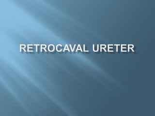 Retrocaval ureter | PPT