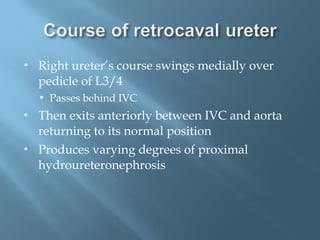 Retrocaval ureter | PPT