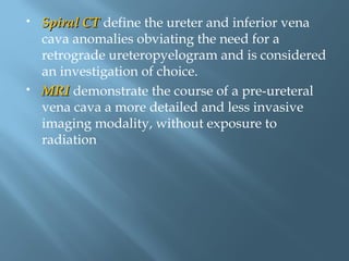 Retrocaval ureter | PPT