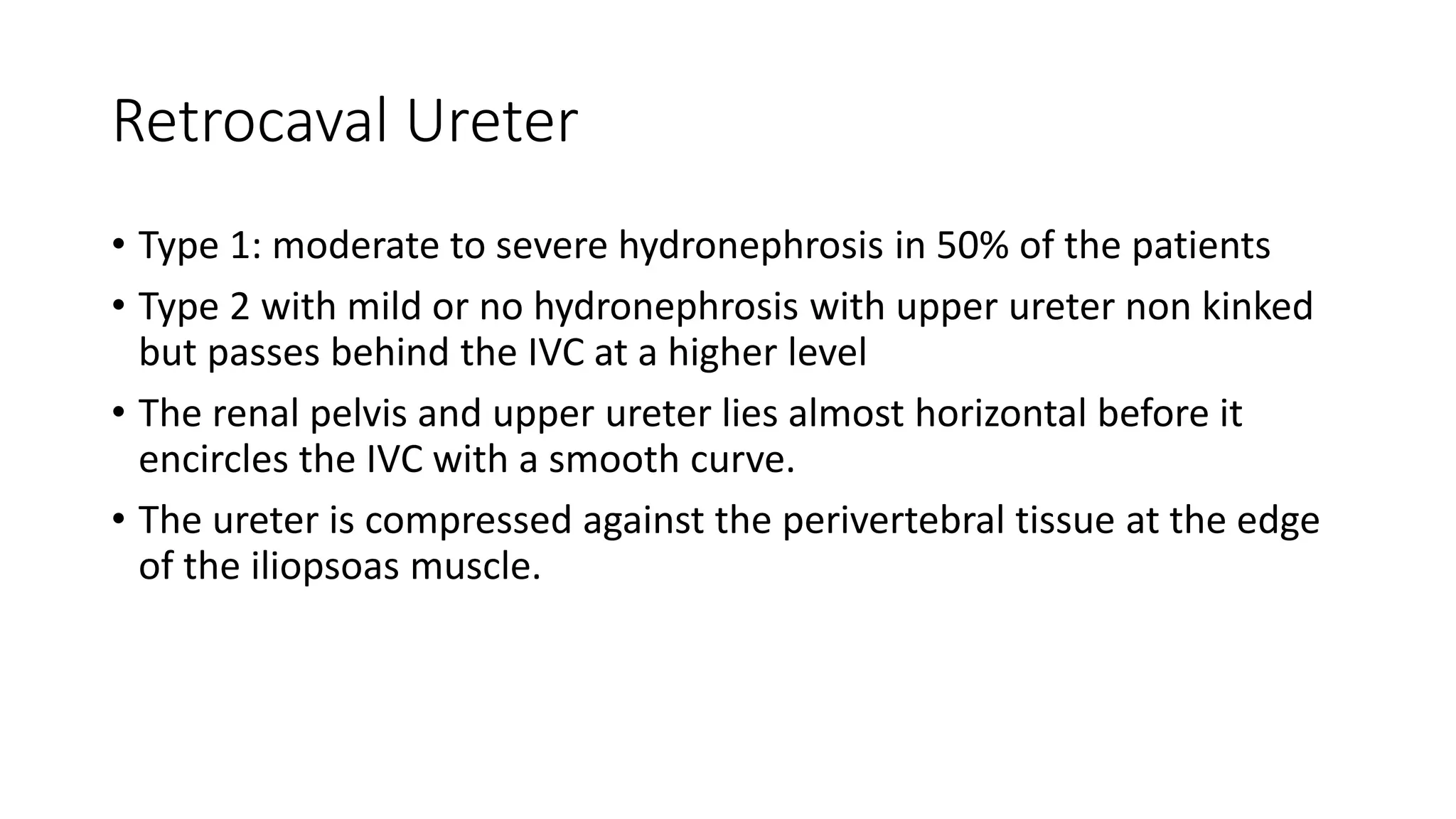 Retrocaval Ureter Urology Anatomy and Management | PPTX