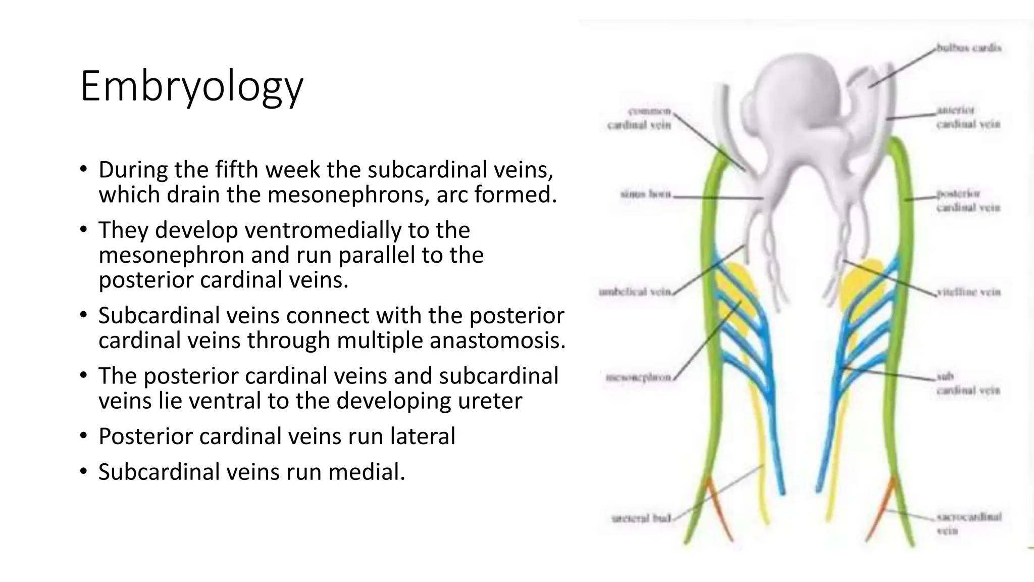 Retrocaval Ureter Urology Anatomy and Management | PPTX