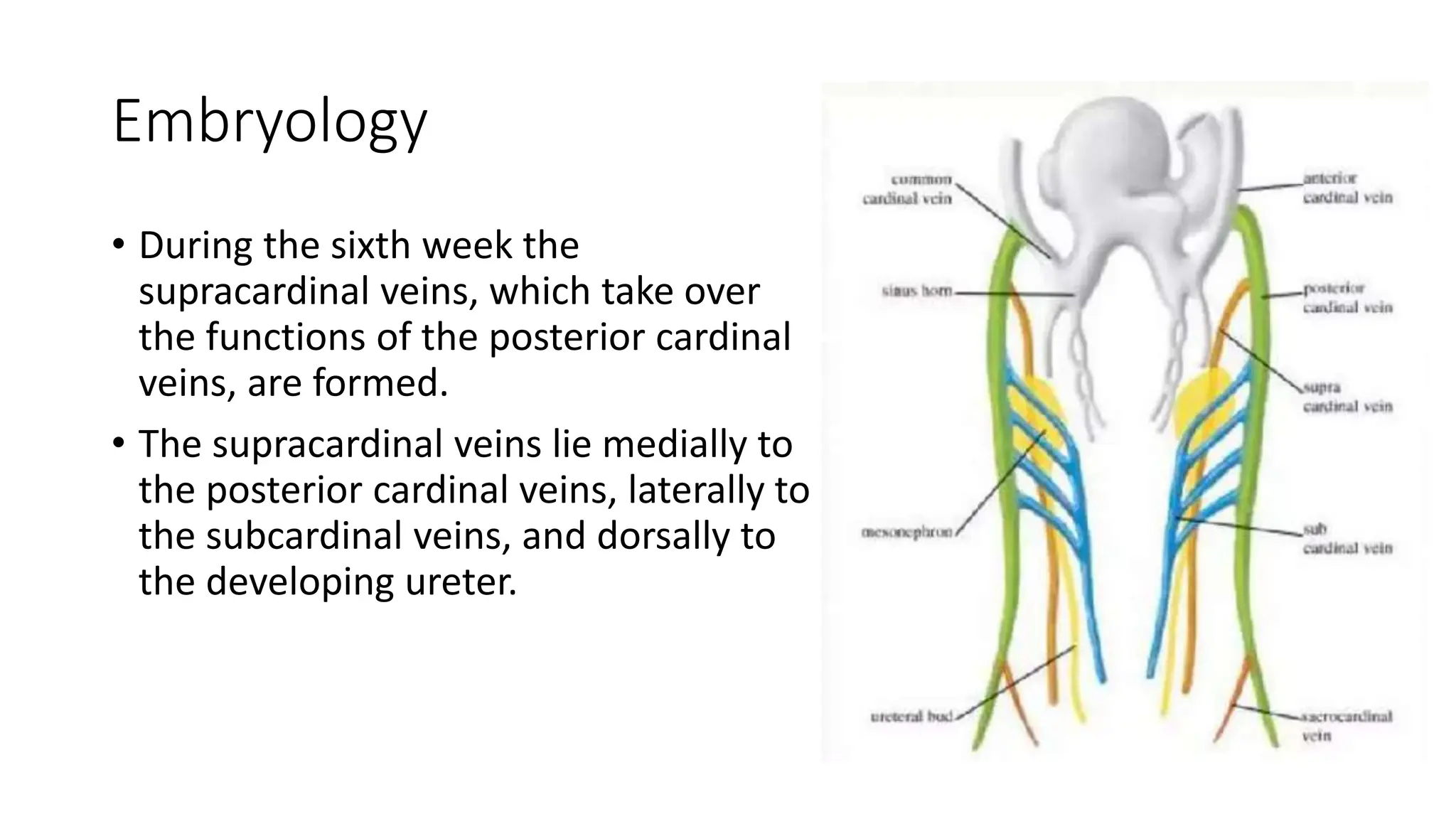 Retrocaval Ureter Urology Anatomy and Management | PPTX