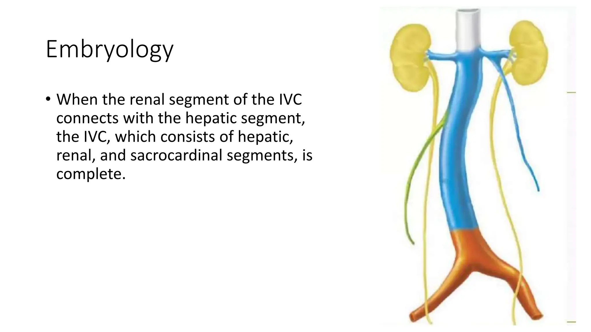 Retrocaval Ureter Urology Anatomy and Management | PPTX