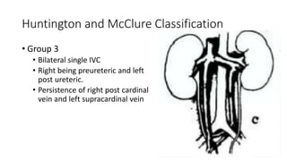 Retrocaval Ureter Urology Anatomy and Management | PPTX