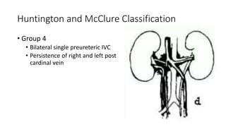 Retrocaval Ureter Urology Anatomy and Management | PPTX