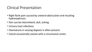 Retrocaval Ureter Urology Anatomy and Management | PPTX