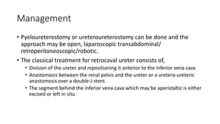 Retrocaval Ureter Urology Anatomy and Management | PPTX