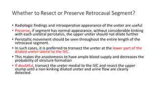 Retrocaval Ureter Urology Anatomy and Management | PPTX