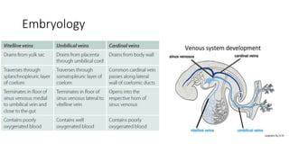Retrocaval Ureter Urology Anatomy and Management | PPTX